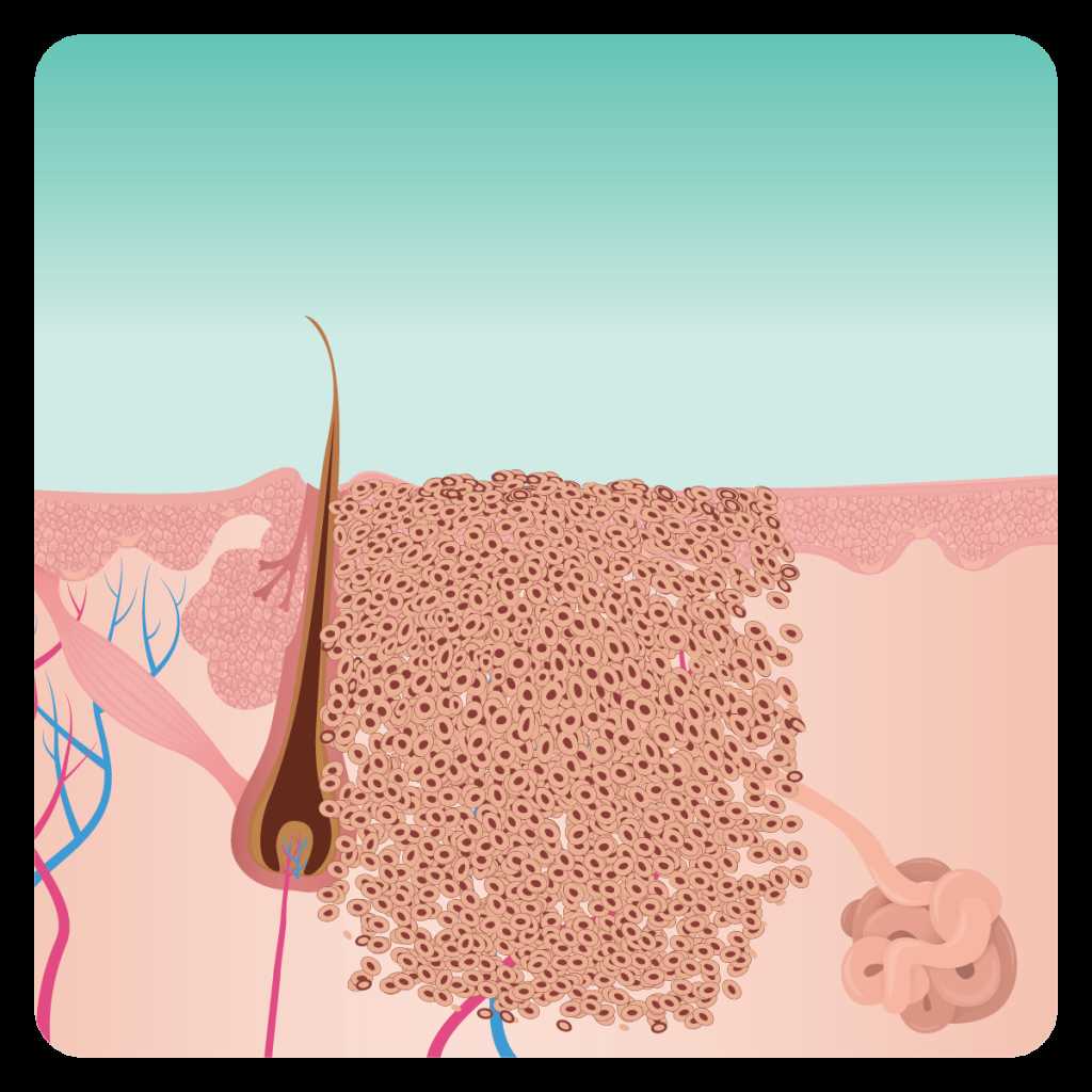 Verruca & Warts Treatment at Cornwall Podiatry